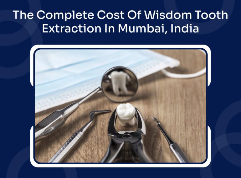 The Complete Cost Of Wisdom Tooth Extraction In Mumbai, India